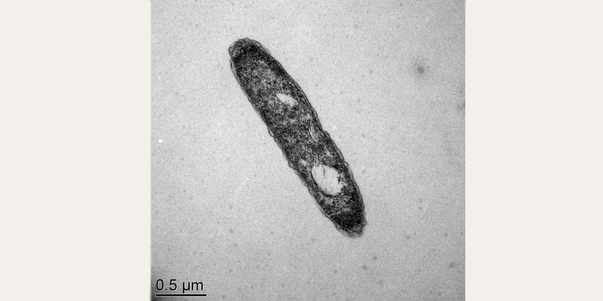 Deep sea microbes can adapt their basic building blocks | NIOZ - Royal ...